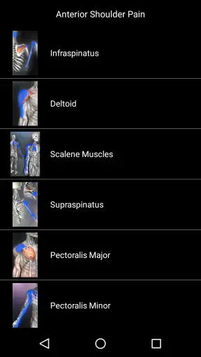 Download Muscle Trigger Point Anatomy - Appcracy