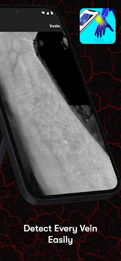 Download X-Vein - Appcracy