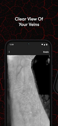 Download X-Vein - Appcracy