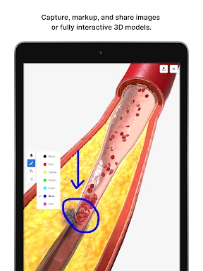 Téléchargez BioDigital Human - 3D Anatomy - Appcracy
