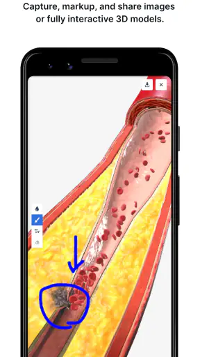 Télécharger BioDigital Human - 3D Anatomy - Appcracy