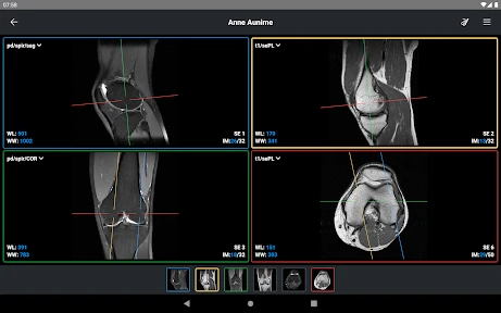 Scarica IDV - IMAIOS DICOM Viewer - Appcracy